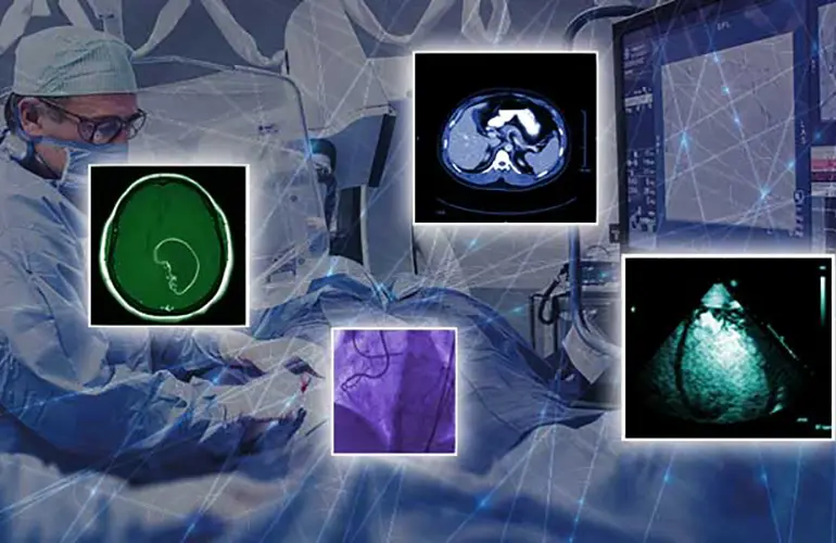 GE HealthCare invests $80M in contrast media ingredients plant